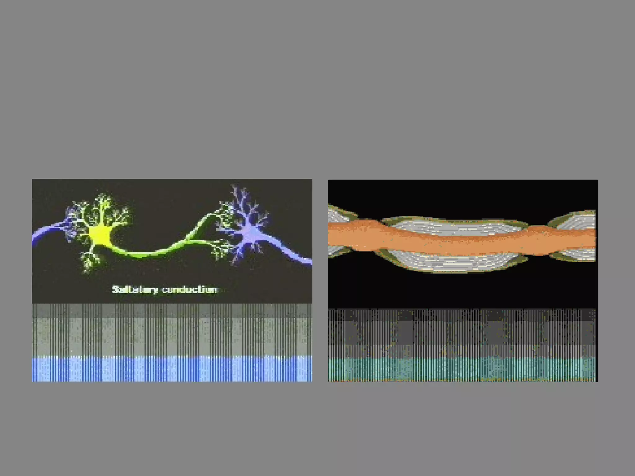 Foot Neuropathy | PPT