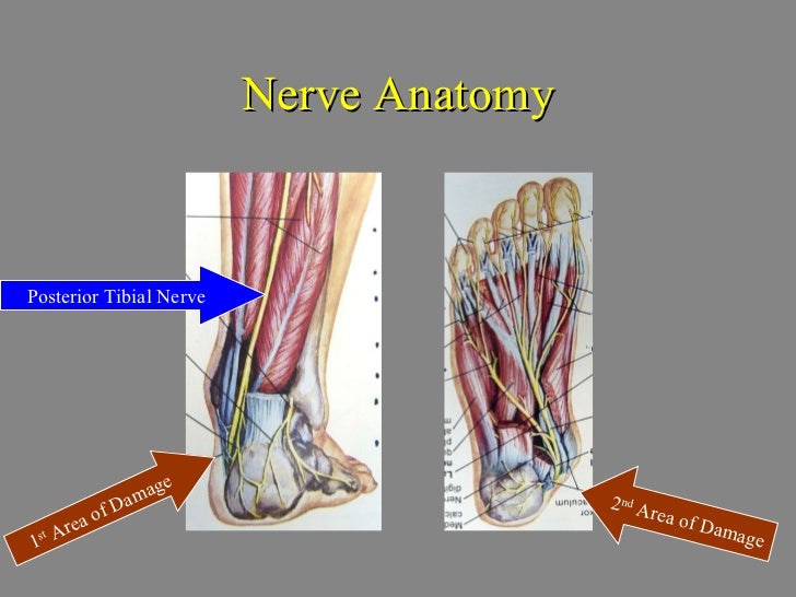 Foot Neuropathy