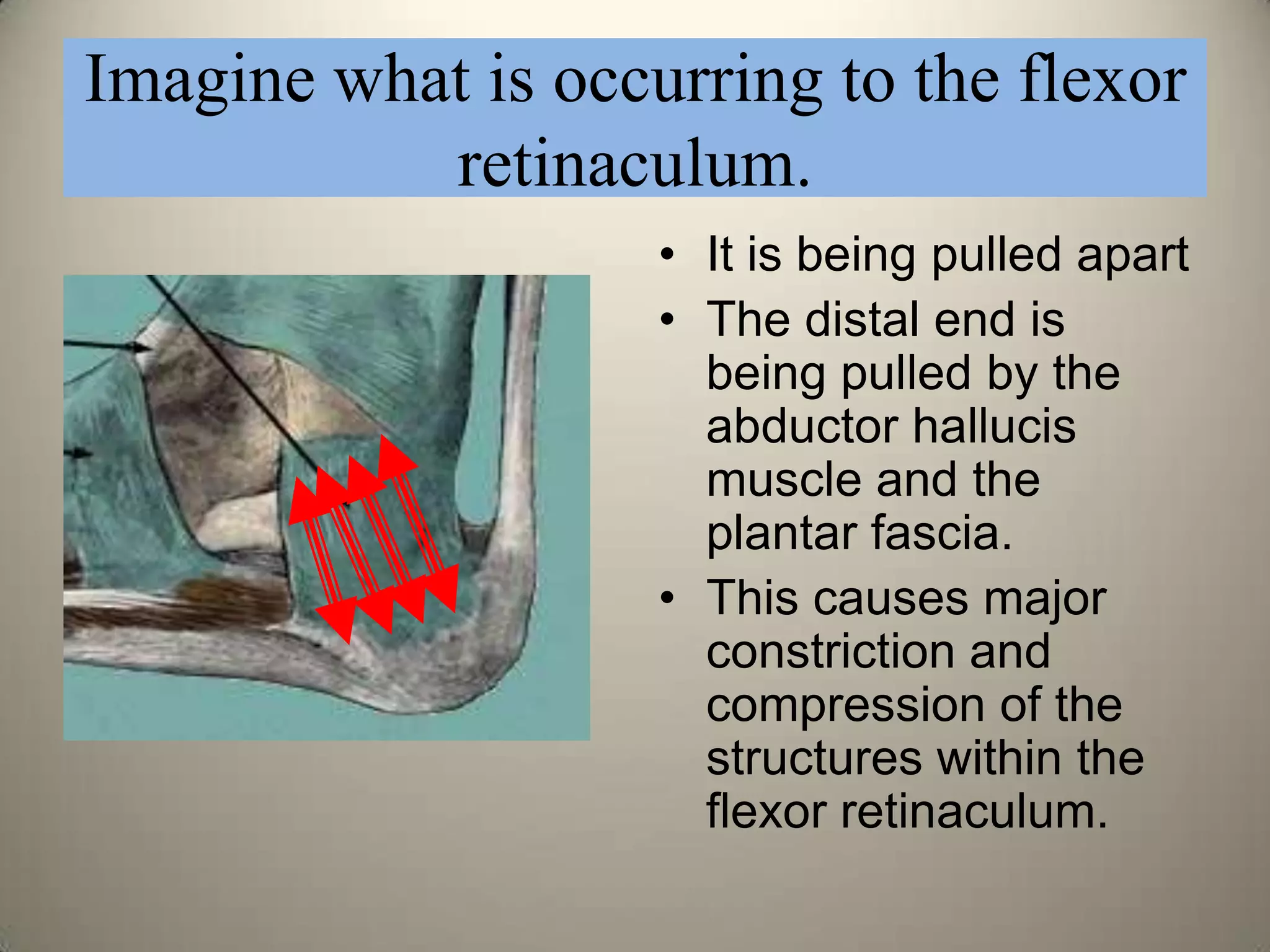 Peripheral Nerve Compression - Neuropathy | PPT