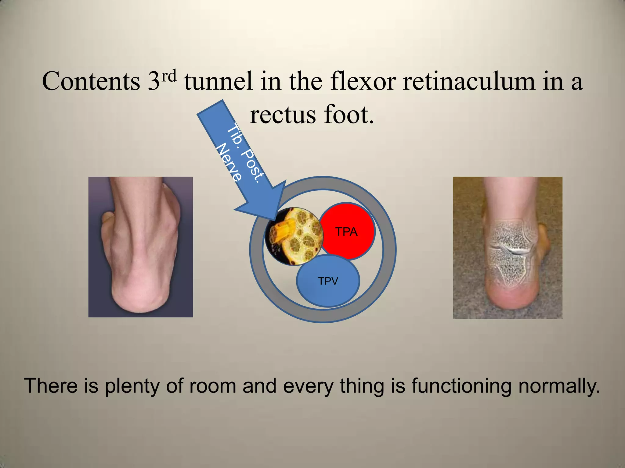 Peripheral Nerve Compression - Neuropathy | PPT