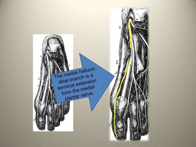 Peripheral Nerve Compression - Neuropathy | PPT