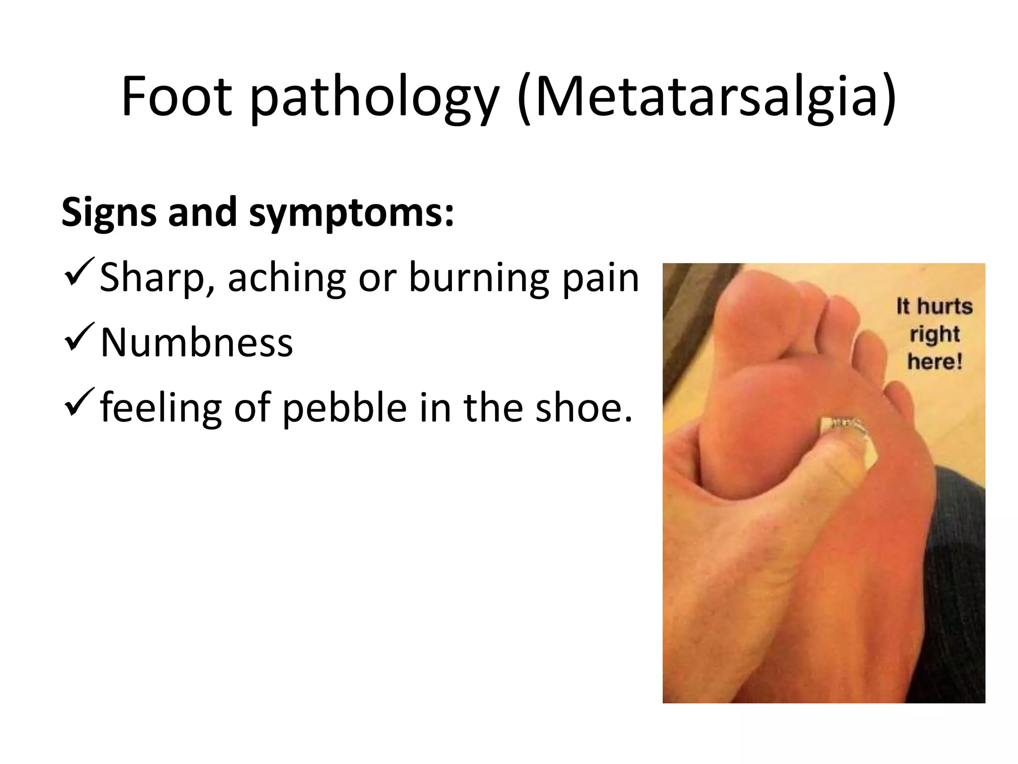 Foot pathology(metatarsalgia) | PPTX