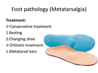 Foot pathology(metatarsalgia) | PPTX