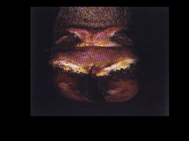 Foot rot | PPS | Foot Health | Diseases and Conditions