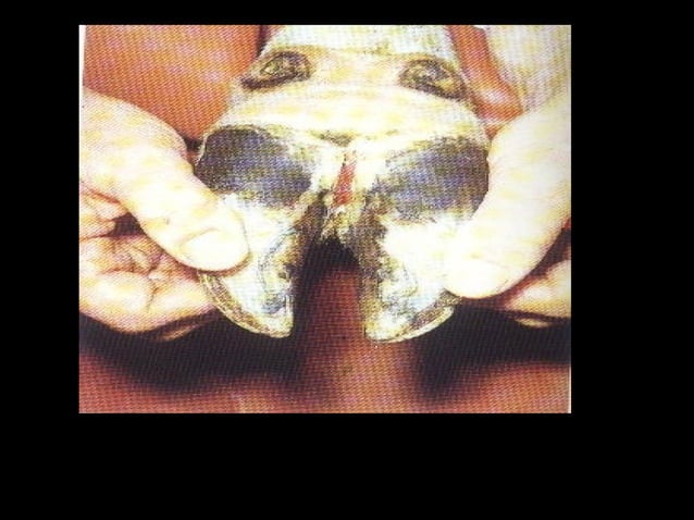 Foot rot | PPS | Foot Health | Diseases and Conditions