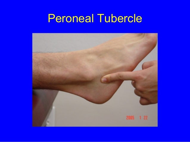 Styloid Process Foot