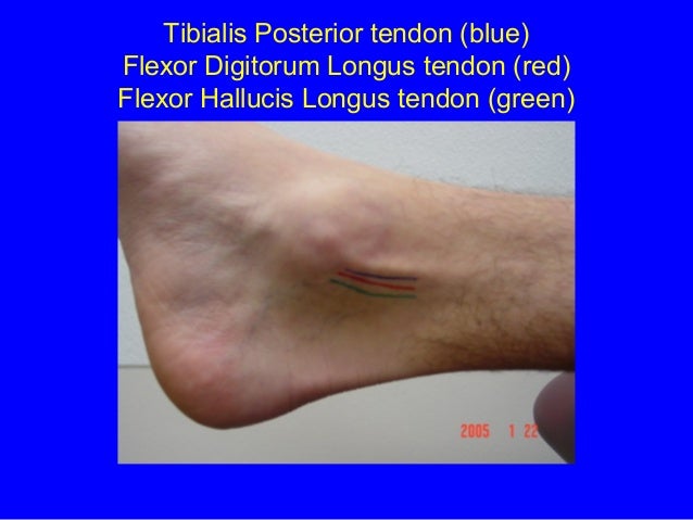 Extensor Hallucis Longus Palpation