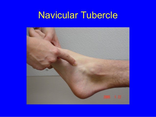 Foot surface anatomy