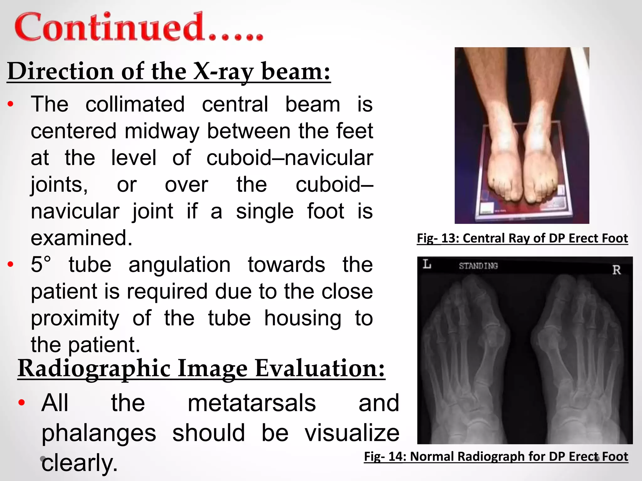 Foot X-ray by Akash Das | PPTX