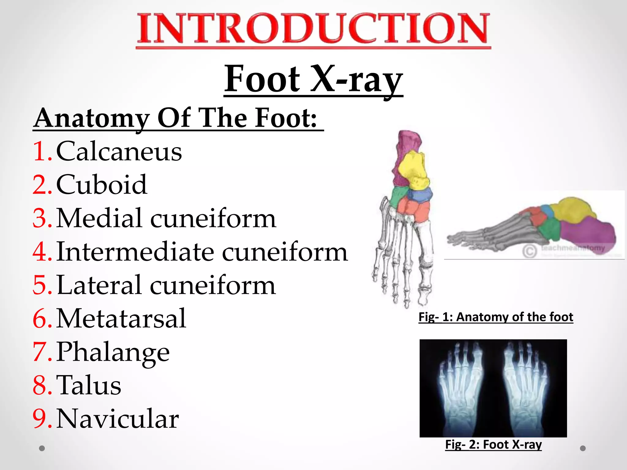 Foot X-ray by Akash Das | PPTX