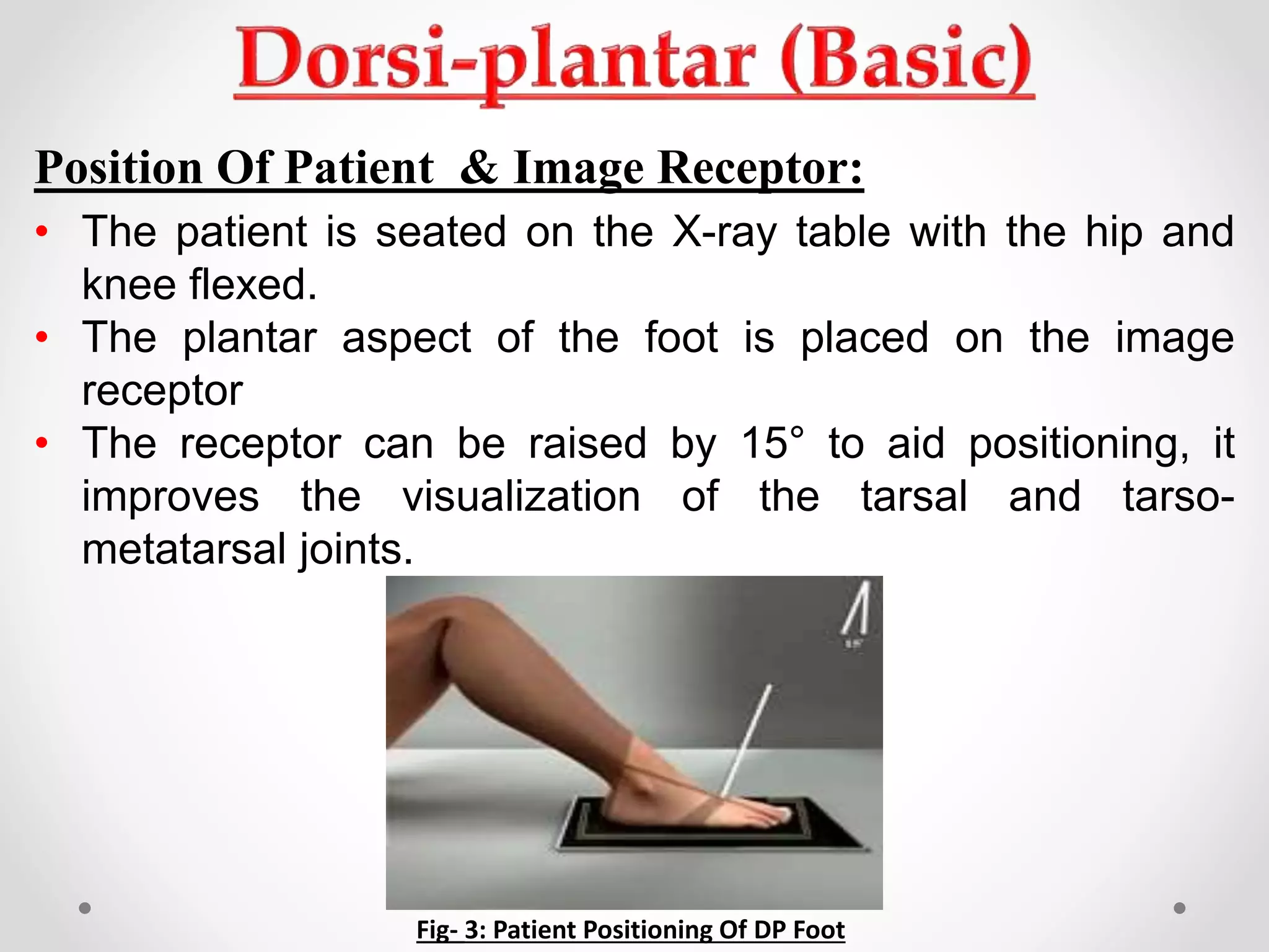 Foot X-ray by Akash Das | PPTX