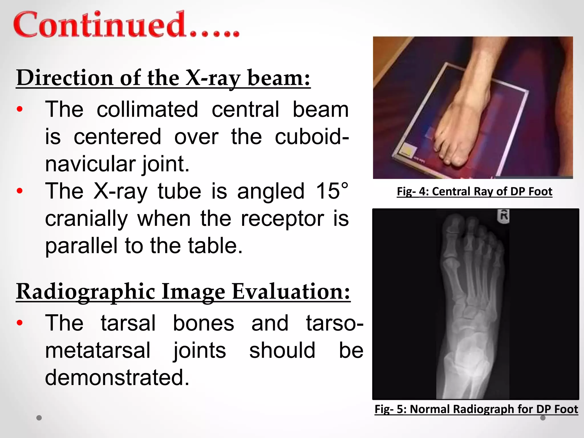 Foot X-ray by Akash Das | PPTX