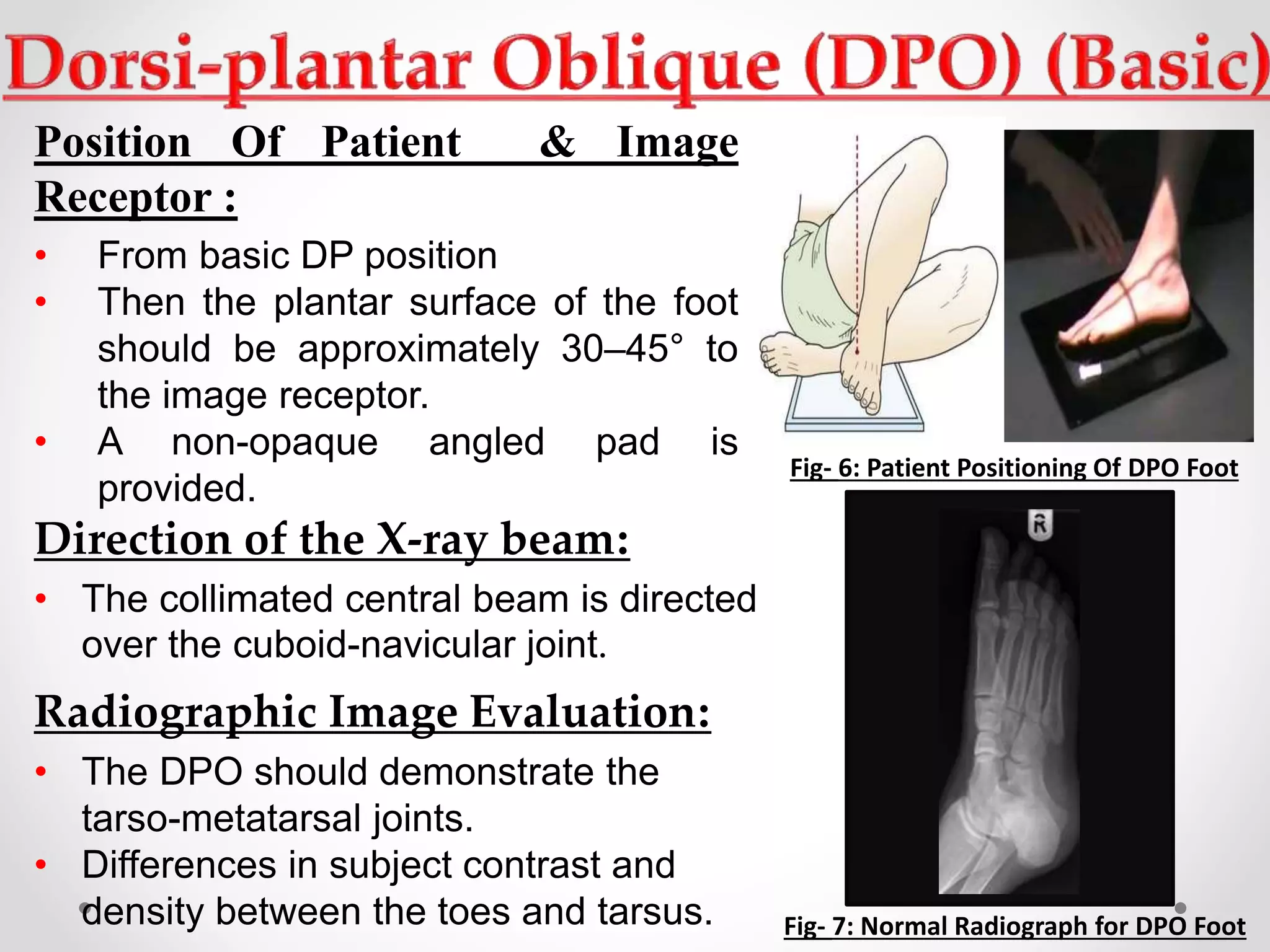 Foot X-ray by Akash Das | PPTX