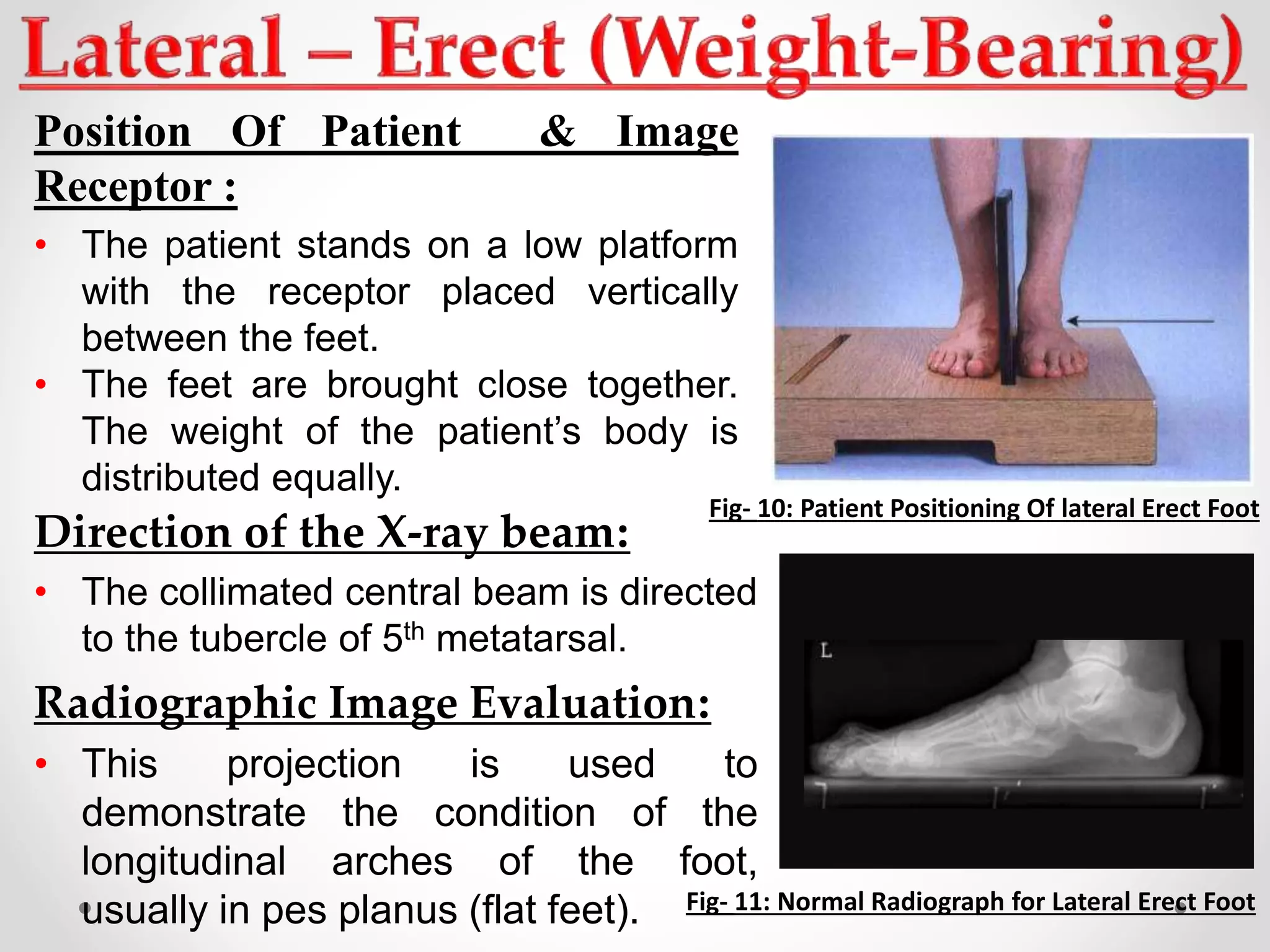 Foot X-ray by Akash Das | PPTX