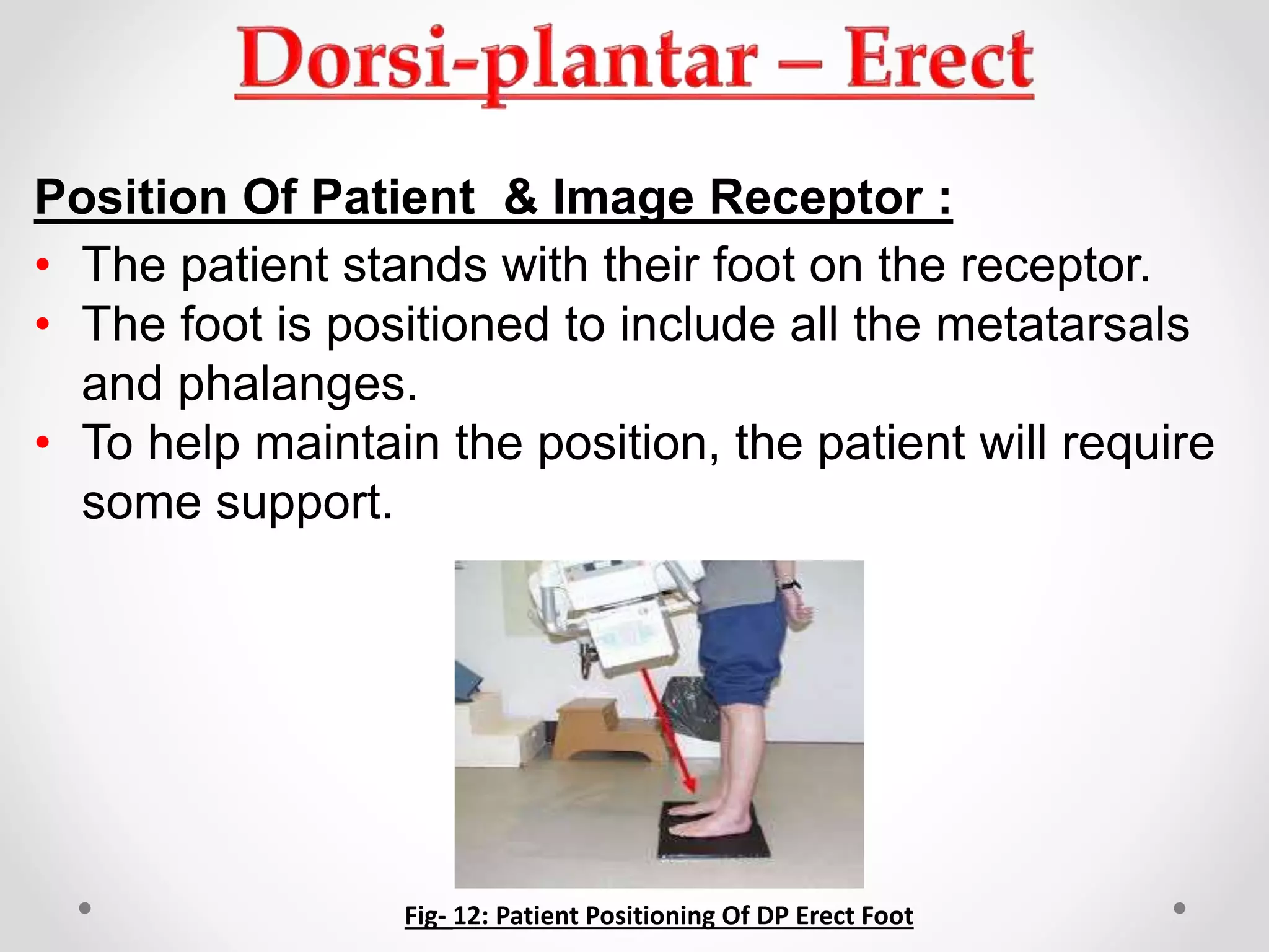 Foot X-ray by Akash Das | PPTX