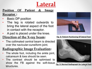 Foot X-ray by Akash Das | PPTX