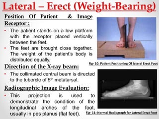 Foot X-ray by Akash Das | PPTX