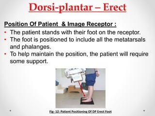Foot X-ray by Akash Das | PPTX