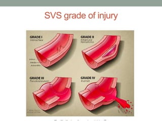 Aorta by Dr Roxanne Wu | PPT