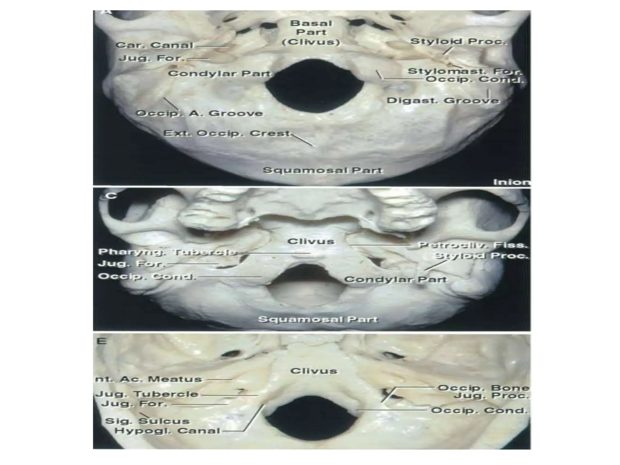 FORAMEN MAGNUM ANATOMY.pptx