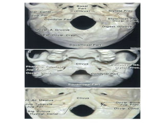 FORAMEN MAGNUM ANATOMY.pptx