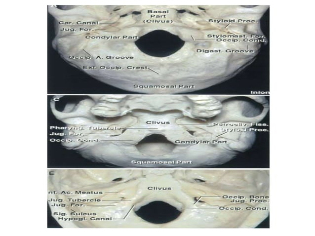 FORAMEN MAGNUM ANATOMY.pptx | Death, Injury, or Military Conflict ...