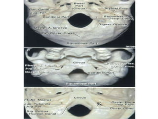 FORAMEN MAGNUM AND ITS SURROUNDING STRUCTURES.pptx