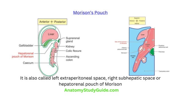 Foramen of Winslow (aditus to lesser sac, epiploic foramen) | PPTX