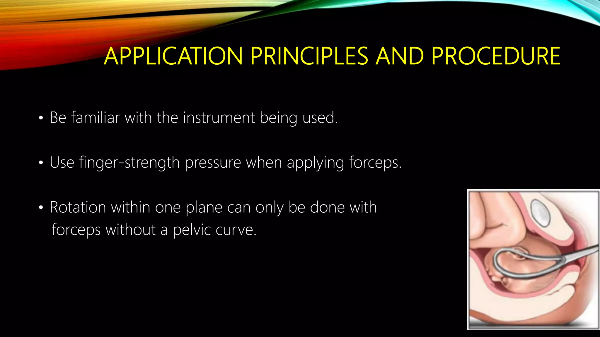 Forceps delivery- Operative Vaginal Delivery | PPTX