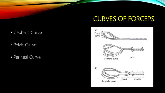 Forceps delivery- Operative Vaginal Delivery | PPTX | Pregnancy ...