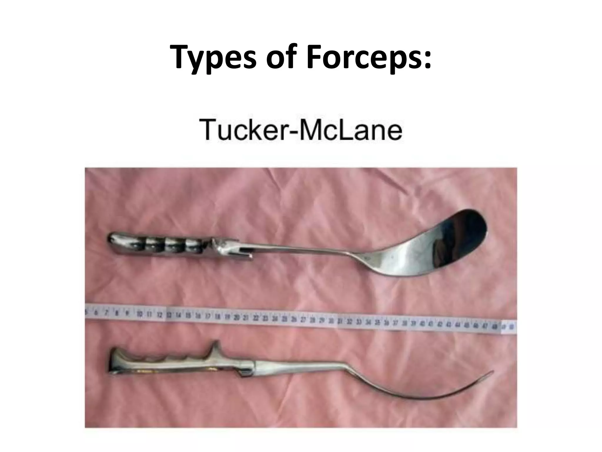 Forcep delivery | PPTX