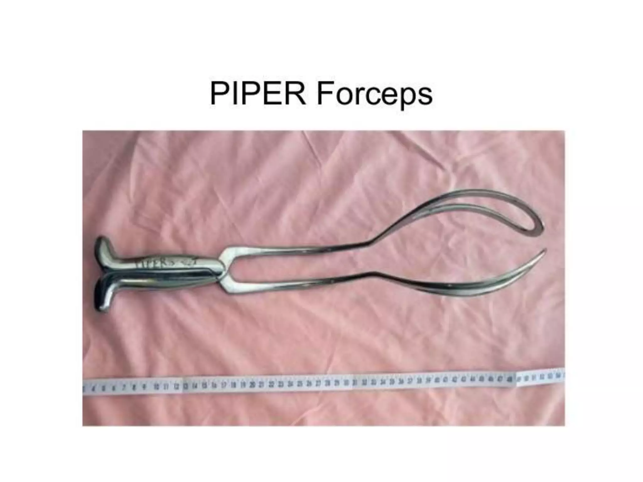 Forcep delivery | PPTX