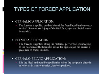 Forcep delivery | PPTX
