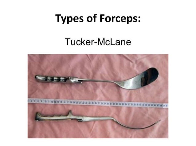 Forcep delivery | PPTX | Pregnancy | Reproductive Health