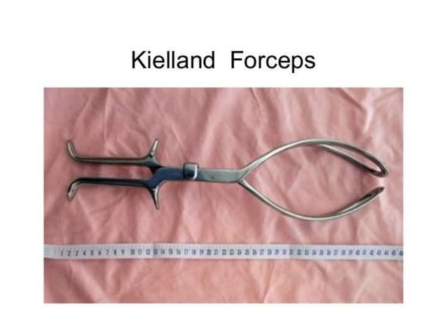Forcep delivery | PPTX | Pregnancy | Reproductive Health