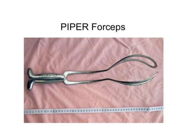 Forcep delivery | PPTX | Pregnancy | Reproductive Health