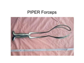 Wrigley Forceps