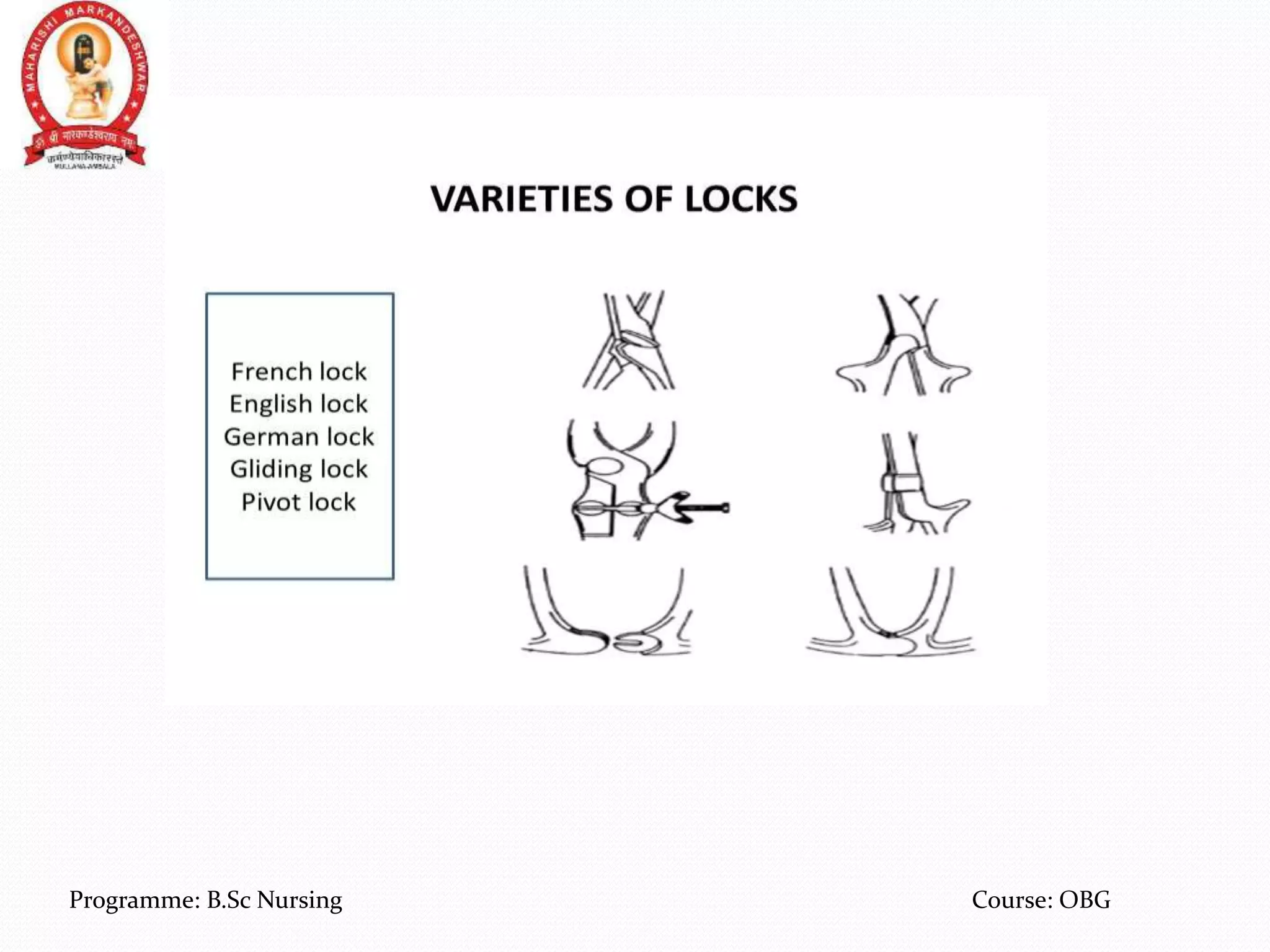 FORCEP DELIVERY.pptx