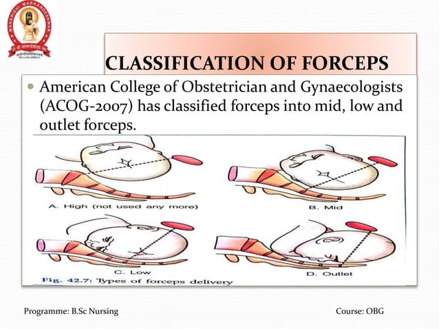 FORCEP DELIVERY.pptx