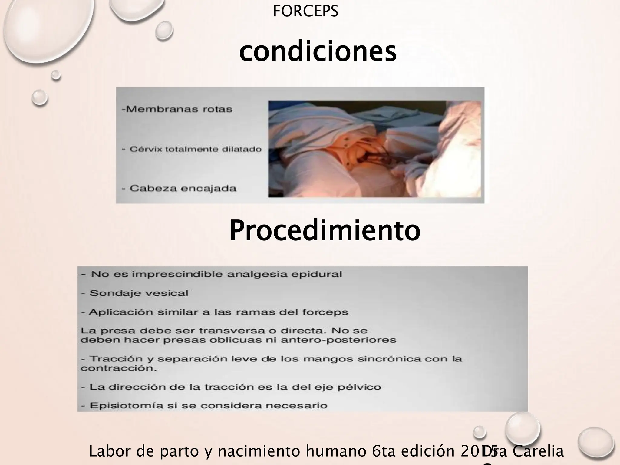 forceps utilizado en el trabajo de parto | PPTX