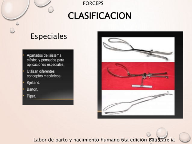 forceps utilizado en el trabajo de parto | PPT