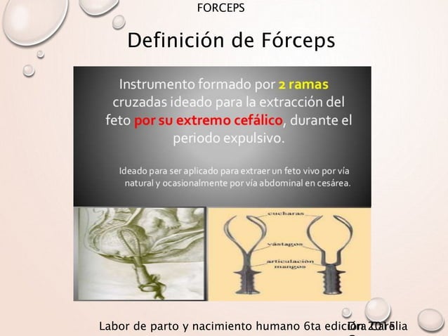 forceps utilizado en el trabajo de parto | PPT