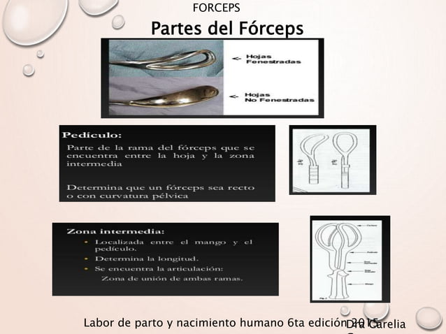 forceps utilizado en el trabajo de parto | PPT