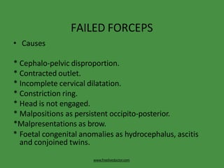 forcepsdeliverx | PPT