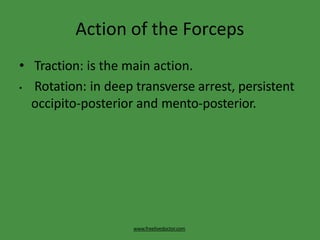 forcepsdeliverx | PPT