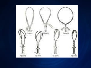 Forceps delivery | PPT | Pregnancy | Reproductive Health