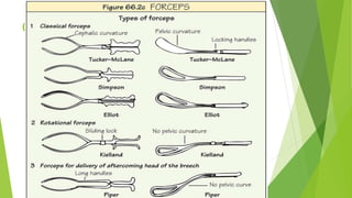Forceps delivery.pptx