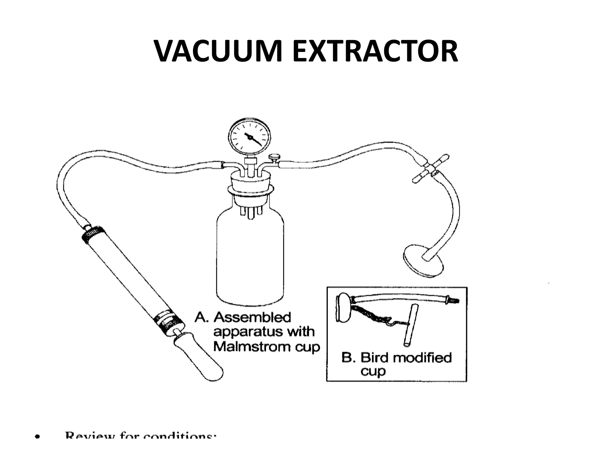 FORCEPS_DELIVERY_AND_VACCUM_EXTRACTION.ppt