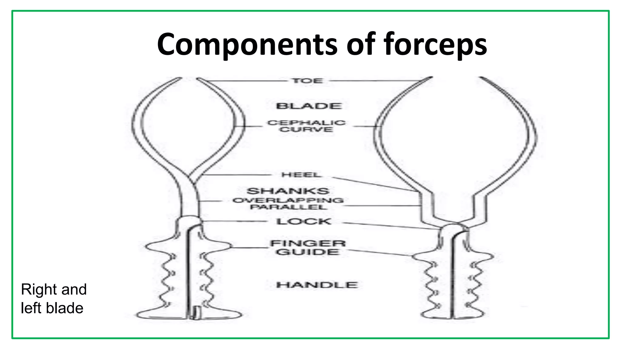 Forceps delivery and vacuum extraction | PPT