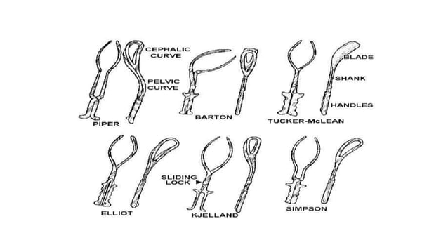 Forceps delivery and vacuum extraction | PPT | Pregnancy | Reproductive ...